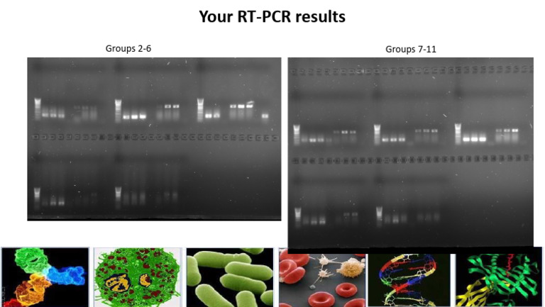Your RT-PCR Results | PDF