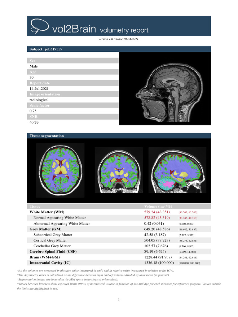 Example Report Vol2brain | PDF | Cingulate Cortex | Frontal Lobe