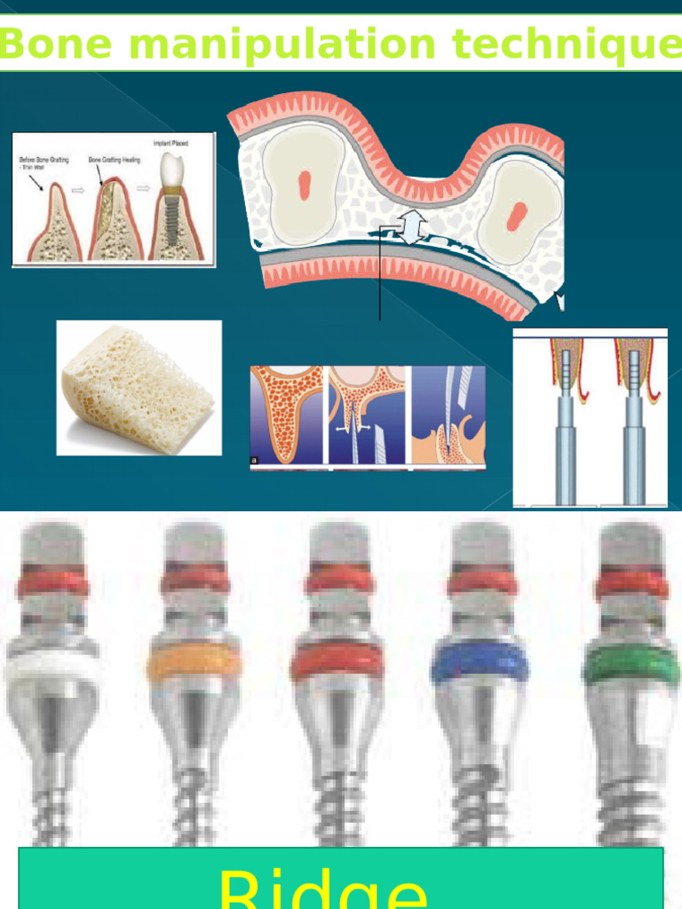 Bone Manipulation Techniques | PDF | Medical Specialties | Surgery