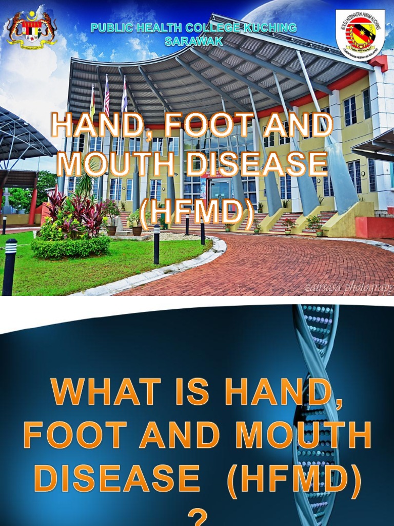 Hand Foot and Mouth Disease (HFMD) | PDF | Veterinary Medicine ...