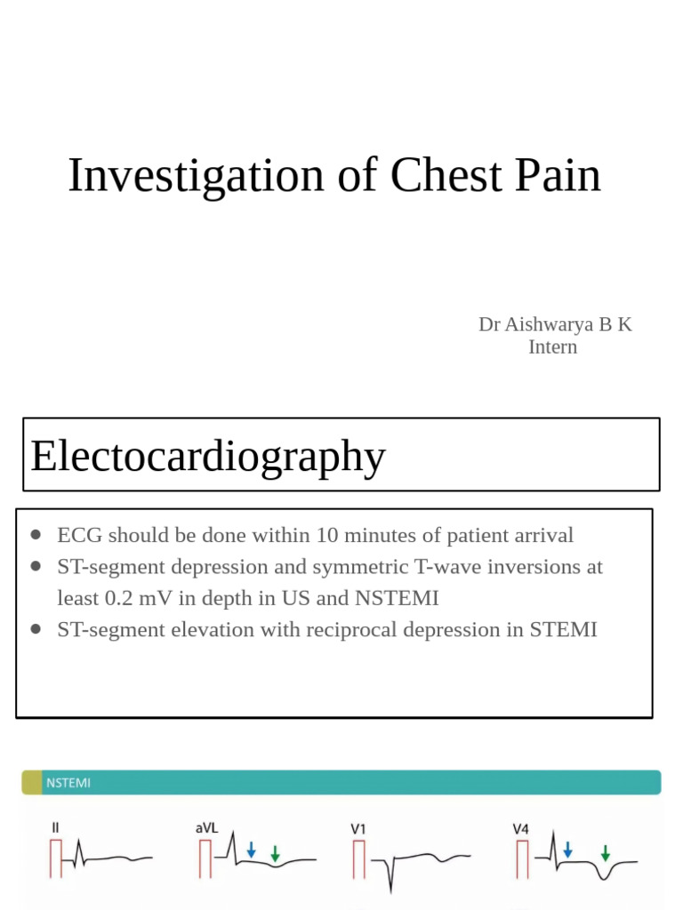 Investigation of Chest Pain | PDF | Myocardial Infarction | Cardiovascular System