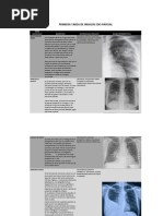 Guía de Signos Radiológicos de Tórax | PDF | Pulmón | Neumonía