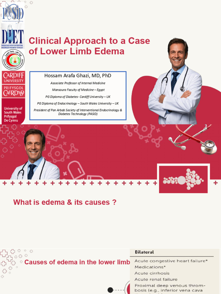 Clincal Approach To Edema LL | PDF
