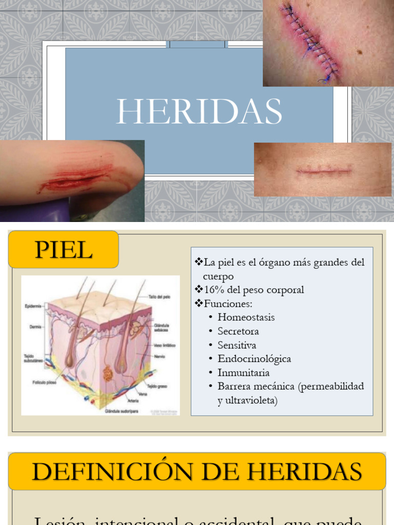 Presentación1 HERIDAS | PDF | Herida | Especialidades Medicas
