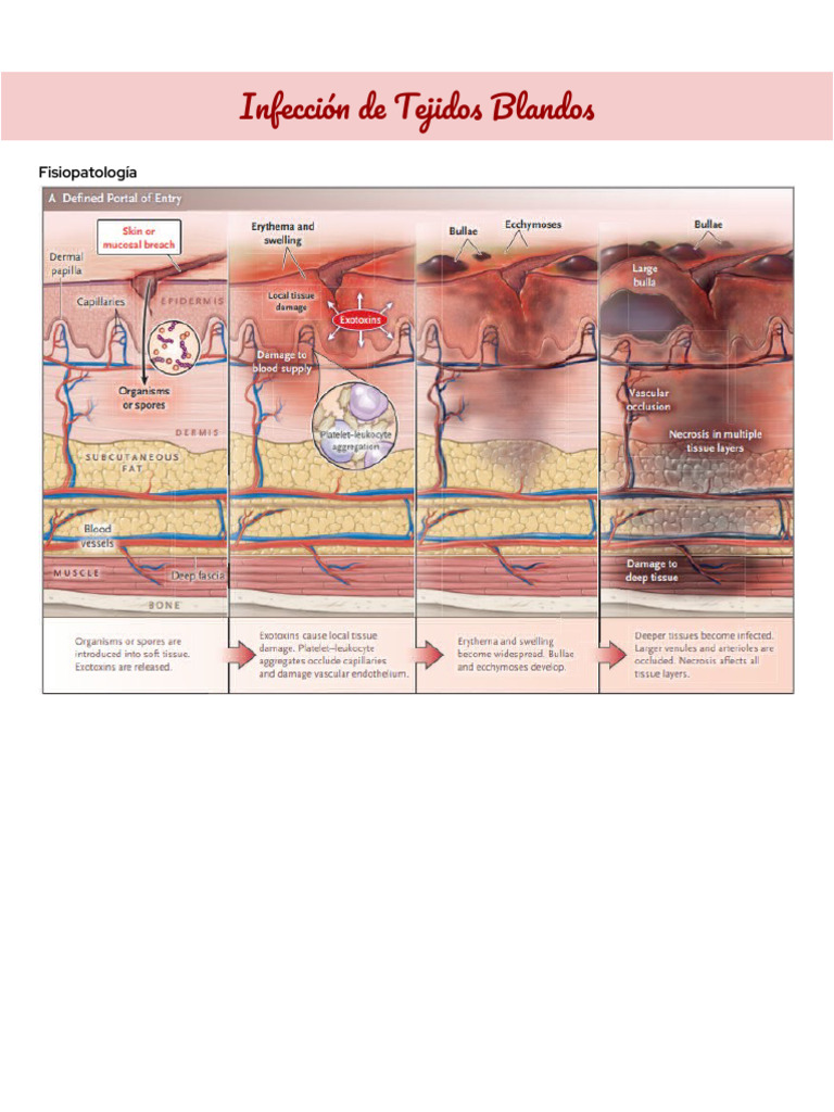 Infección de Tejidos Blandos | PDF