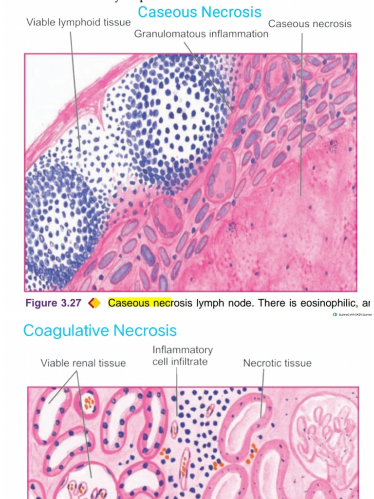 Pathology Histological Slides | PDF