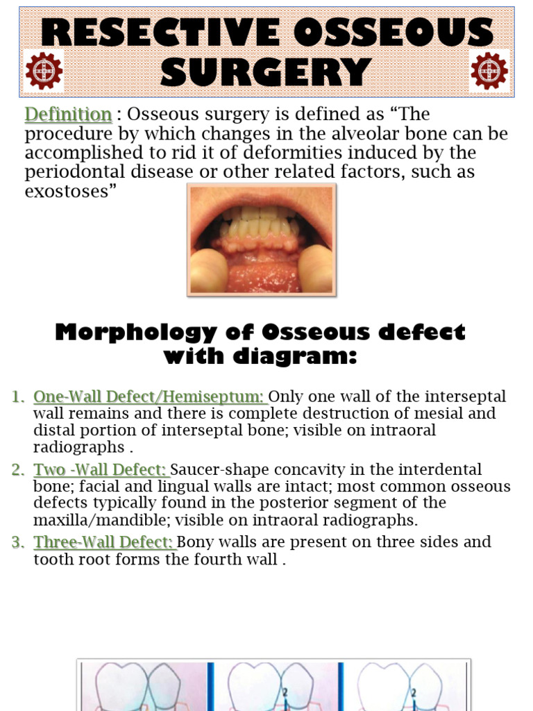 Resective Osseous Surgery | PDF | Periodontology | Medical Specialties