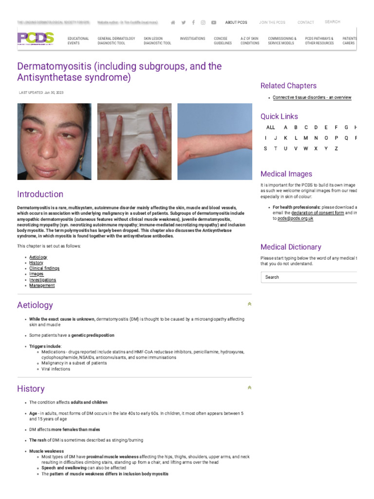 Overview of Dermatomyositis | PDF | Medicine | Human Diseases And Disorders