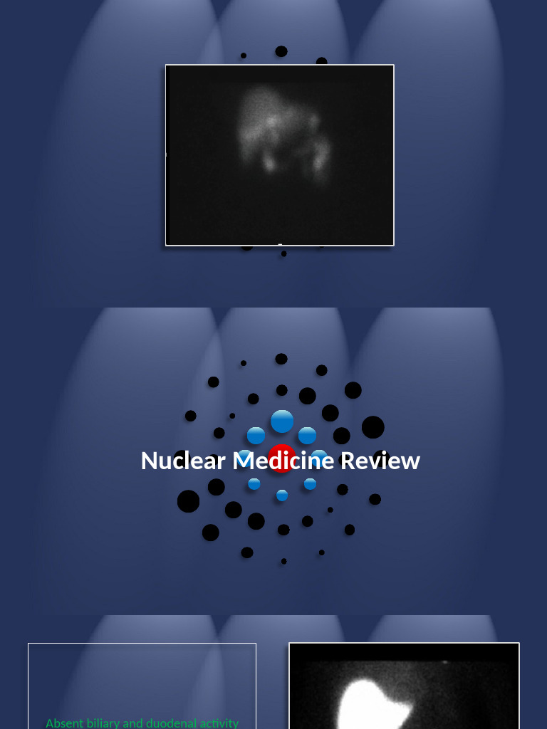 Nuclear Medicine Review 45 | PDF | Gallbladder | Liver
