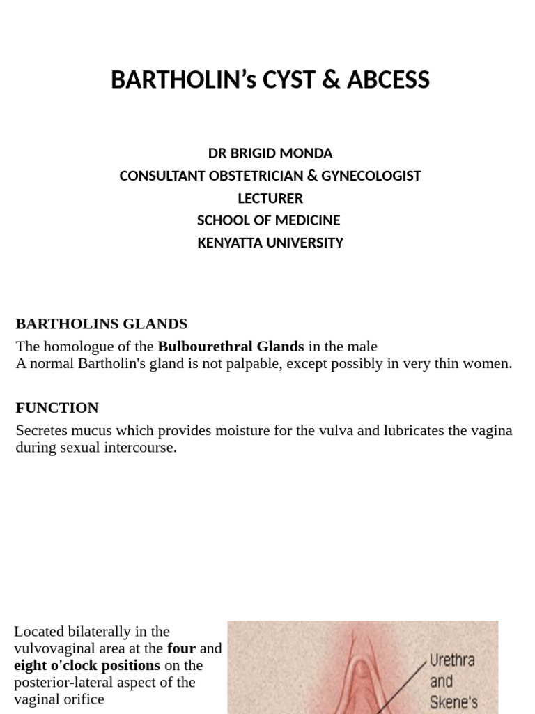 2 - Bartholins Cyst & Abcess-2024 | PDF | Vagina | Clinical Medicine