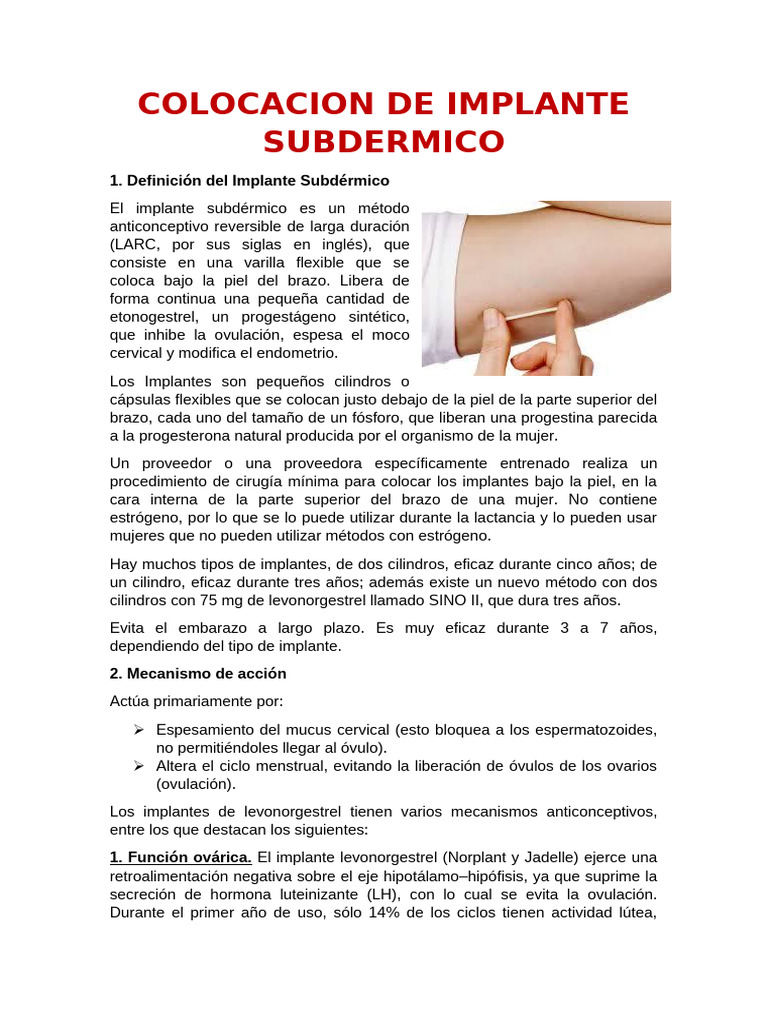 Guía Completa sobre Implantes Subdérmicos | PDF | Ciclo menstrual ...