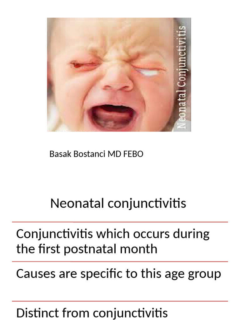 Neonatal Conjunctivitis Overview | PDF | Clinical Medicine | Human ...