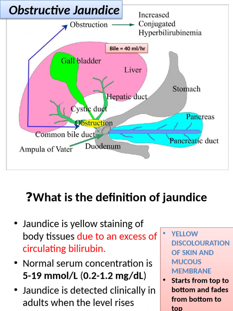 Obstructive Jaundice | PDF | Bile | Alanine Transaminase