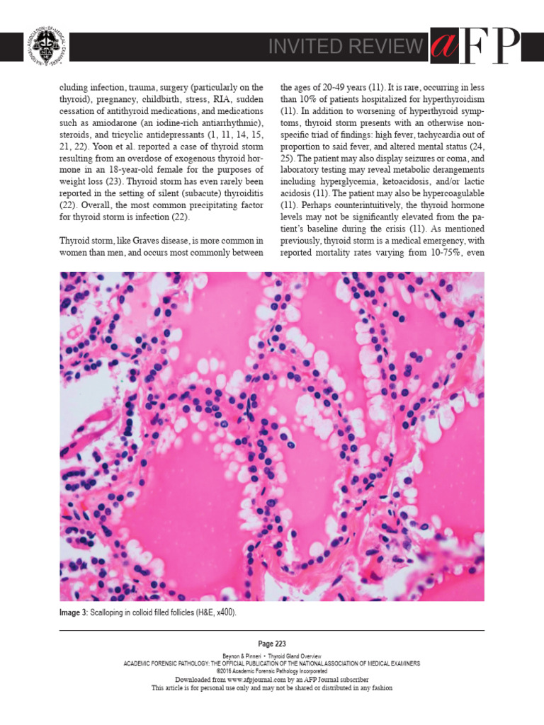 An Overview of The Thyroid Gland and Thyroid-Related Deaths For The ...