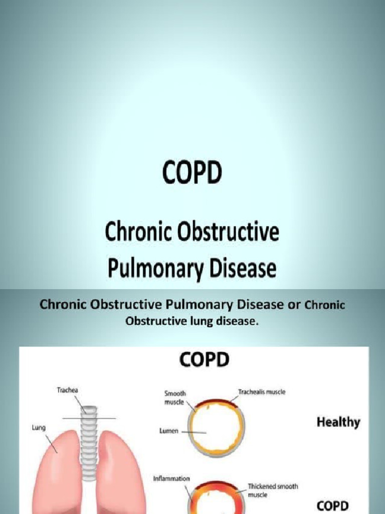 Copd | PDF