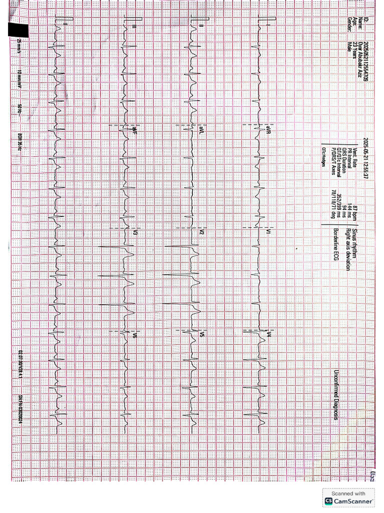 ECG Test | PDF