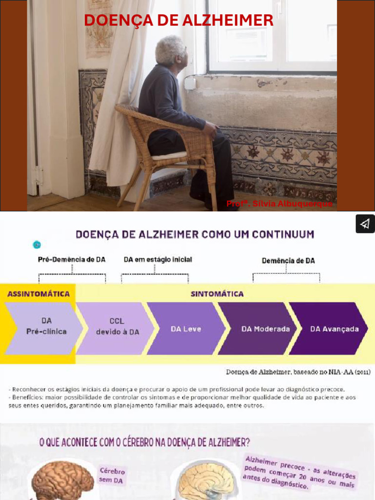 Entendendo a Doença de Alzheimer | PDF