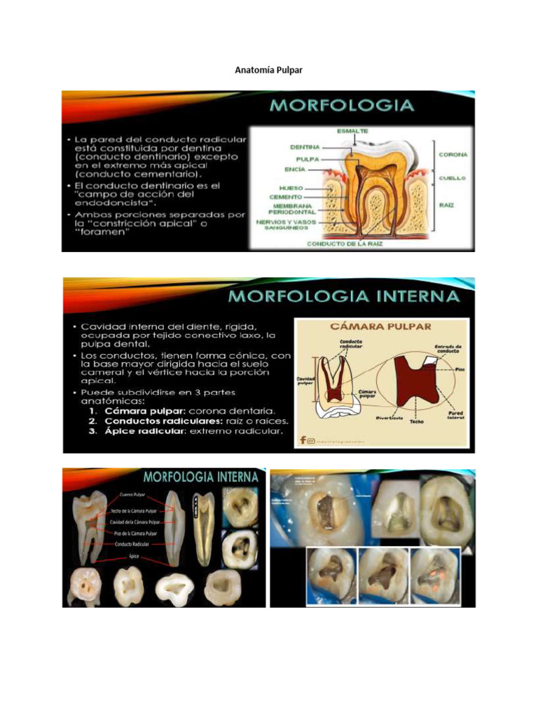 Anatomía Pulpar | PDF