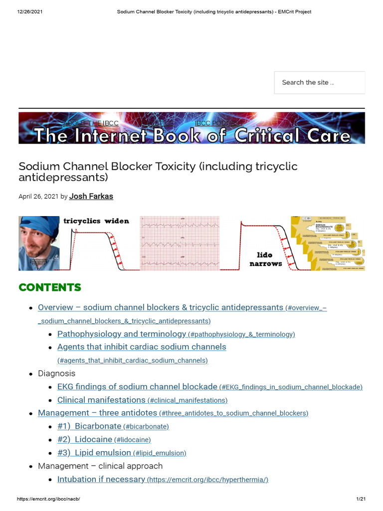 Sodium Channel Blocker Toxicity (Including Tricyclic Antidepressants ...