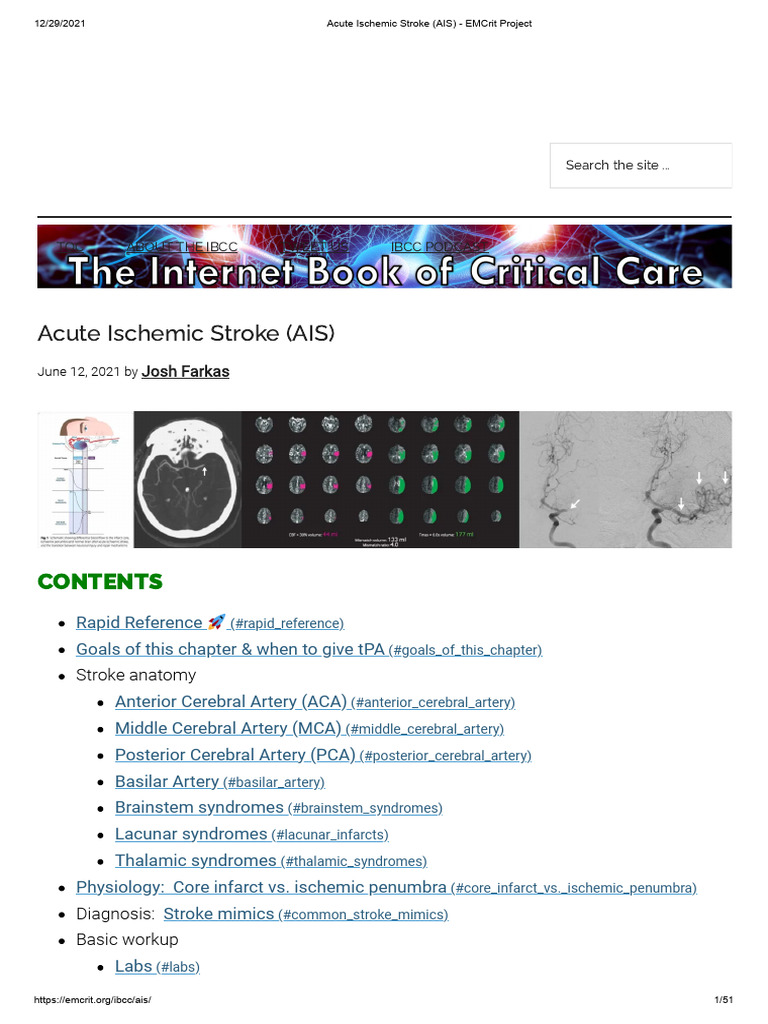Acute Ischemic Stroke Management Guide | PDF | Stroke | Thalamus
