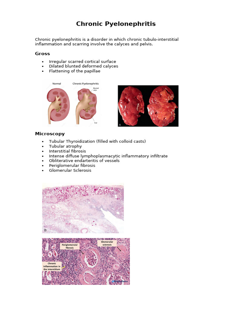 Renal - Chronic Pyelonephritis | PDF