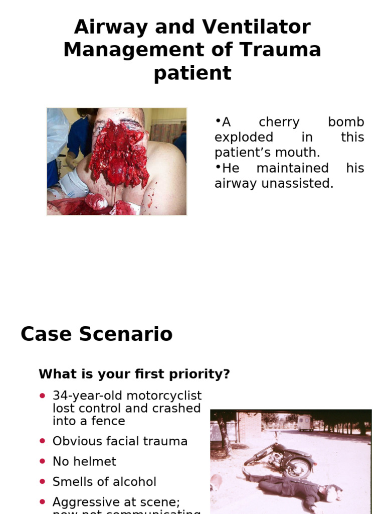 Airway Management in Trauma Patients | PDF | Respiratory System ...