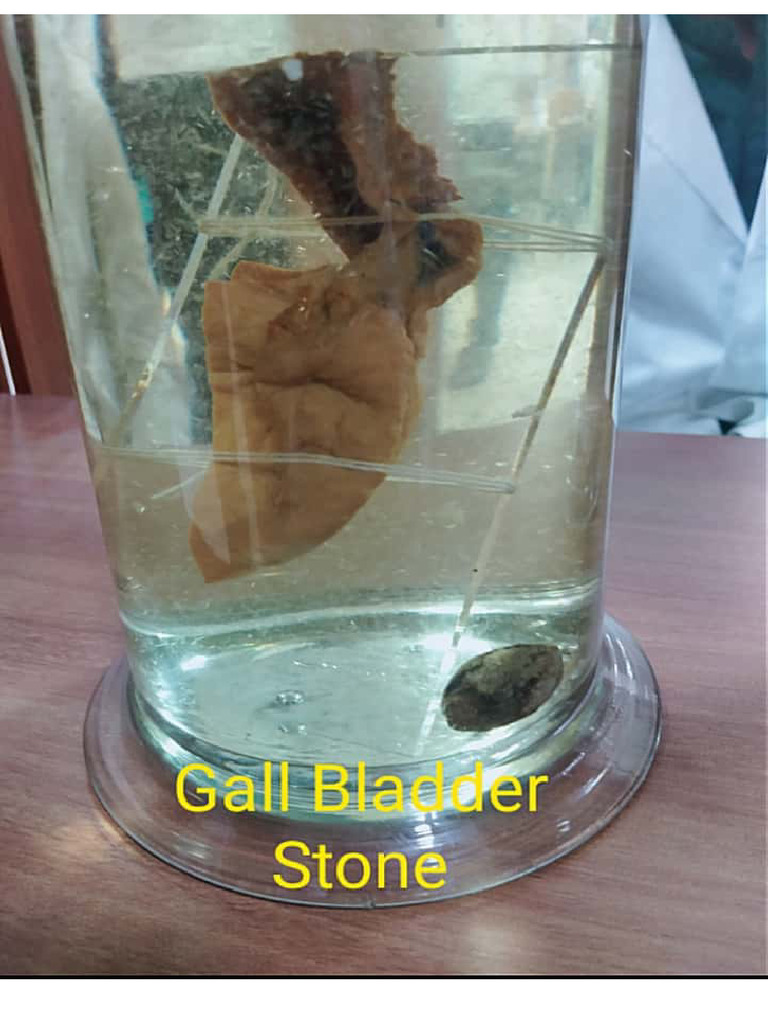 Pathology Specimen | PDF