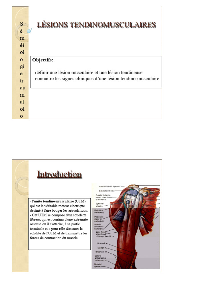 004 LESIONS TENDINOMUSCULAIRES (1) Berrada GRR | PDF | Tendon | Muscle