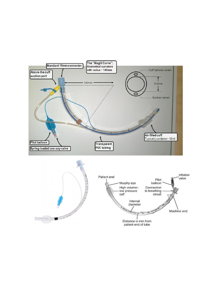 Airway Devices (Infraglottic) - Endotracheal Tube & Suction Catheter ...