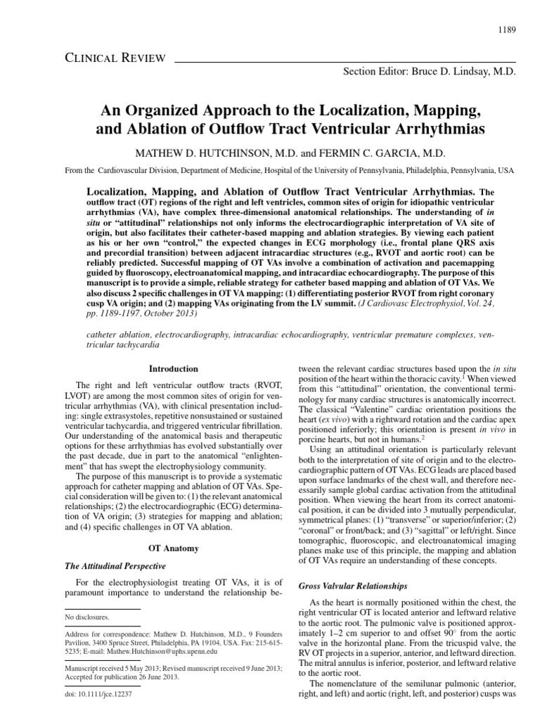 An Organized Approach to the Localization, Mapping, and Ablation of Outflow Tract Ventricular ...