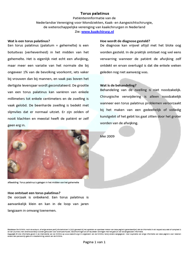 torus-palatinus | PDF
