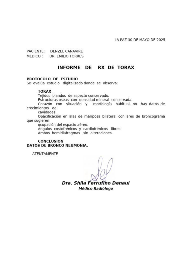 Denzel Canavire | PDF