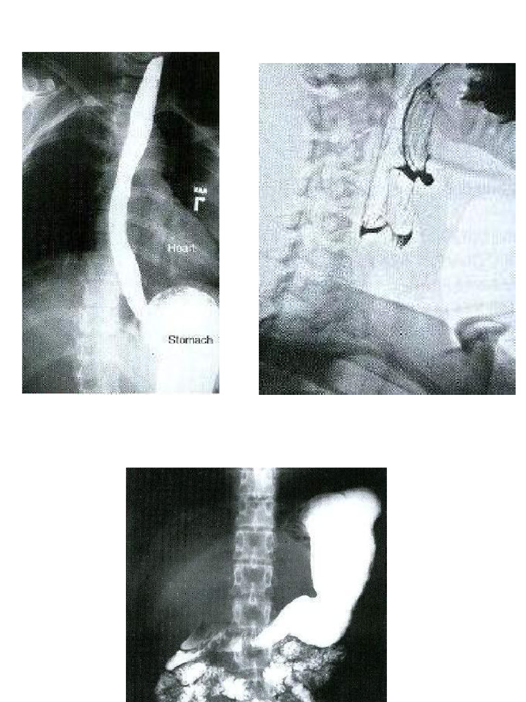 Aula 2 TP III - Exames Contrastados | PDF