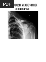 Apófisis Coracoides | PDF | Hombro | Extremidades (anatomía)