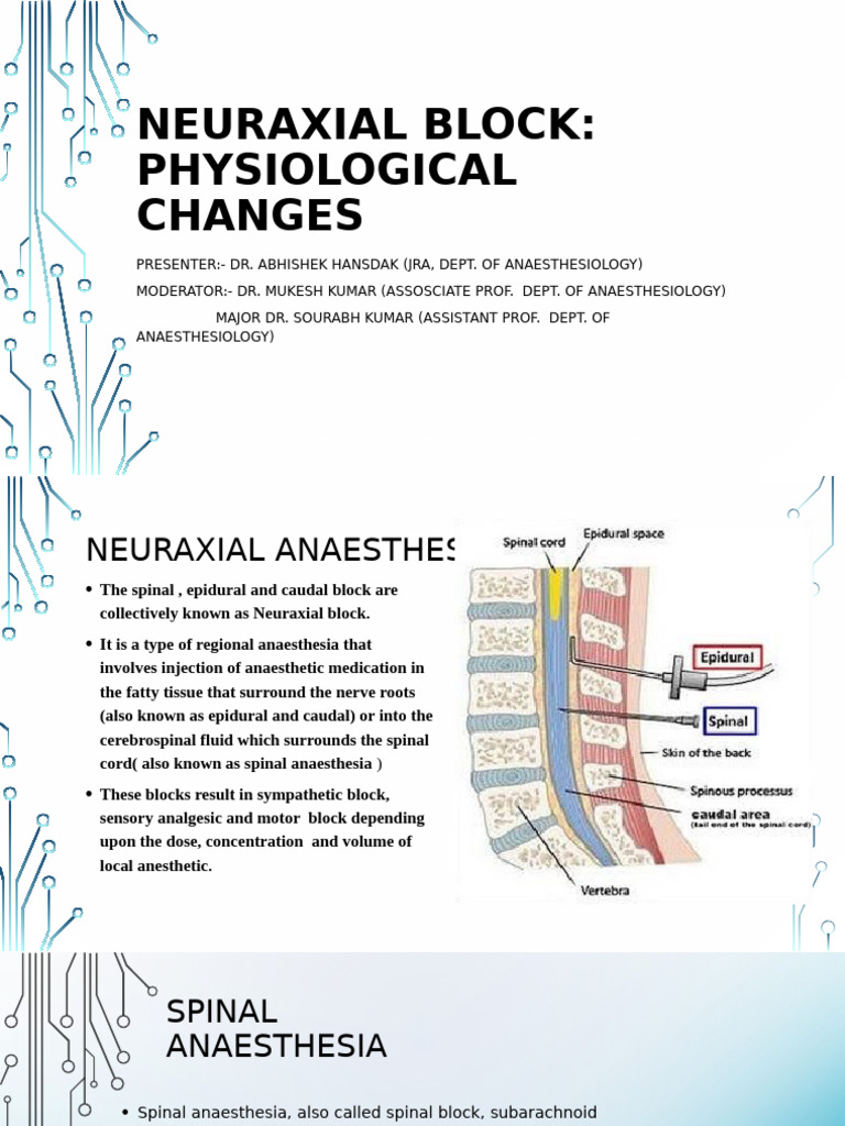 Neuraxial Block Abhishek (4) | PDF | Vertebral Column | Anesthesia