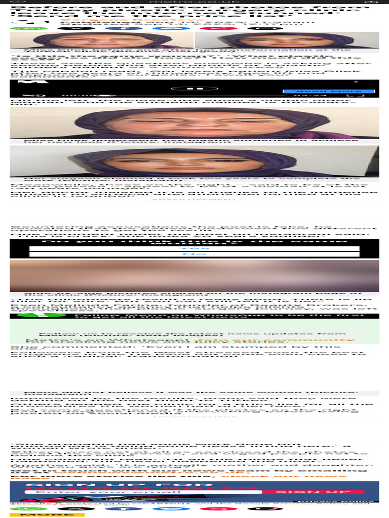 Before and After Photos From Turkey Plastic Surgery Clinic Go Viral ...