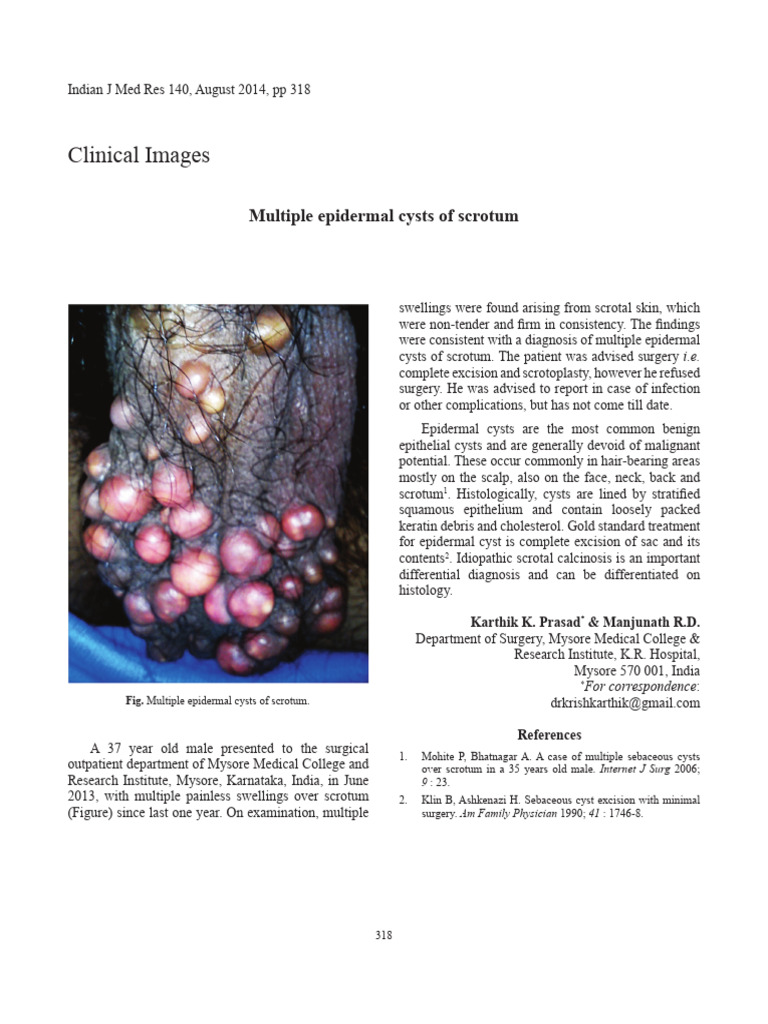 Multiple Epidermal Cysts of Scrotum | PDF | Medical Specialties ...