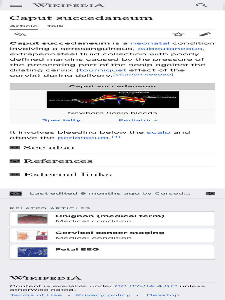 Caput Succedaneum - Wikipedia | PDF