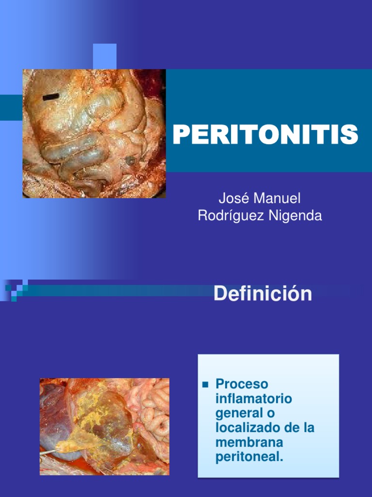 Peritonitis | PDF | Inflamación | Citocina