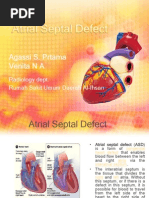 Abnormal ECG Findings in Athletes: Seattle Criteria | PDF ...