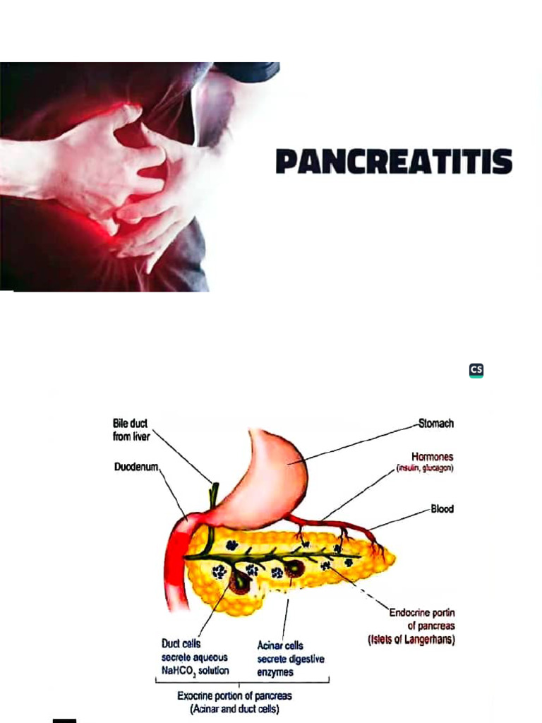 Pancreatitis | PDF
