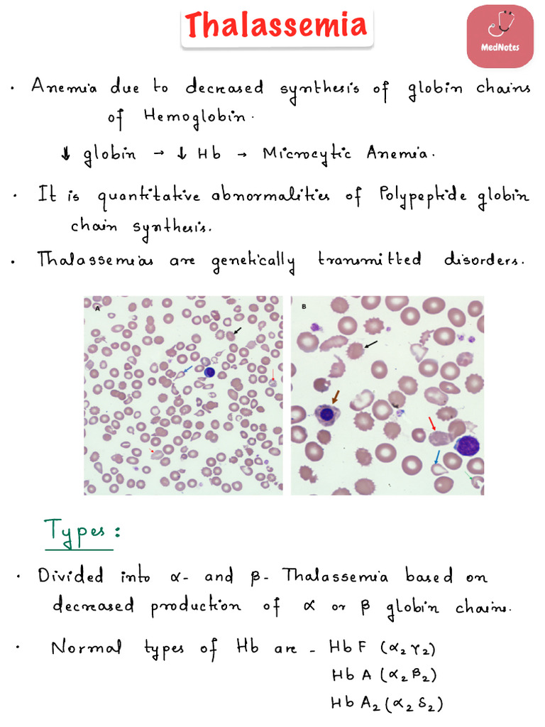 Anemia - 3 (Thalassemia) | PDF