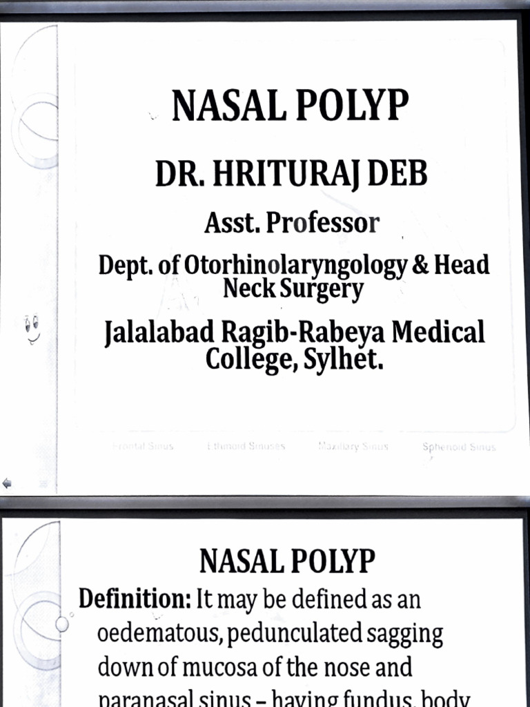 Nasal Polyp - 1 | PDF | Human Nose | Diseases And Disorders