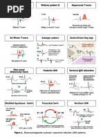 Wellens Syndrome ECG Patterns Explained | PDF | Electrocardiography ...