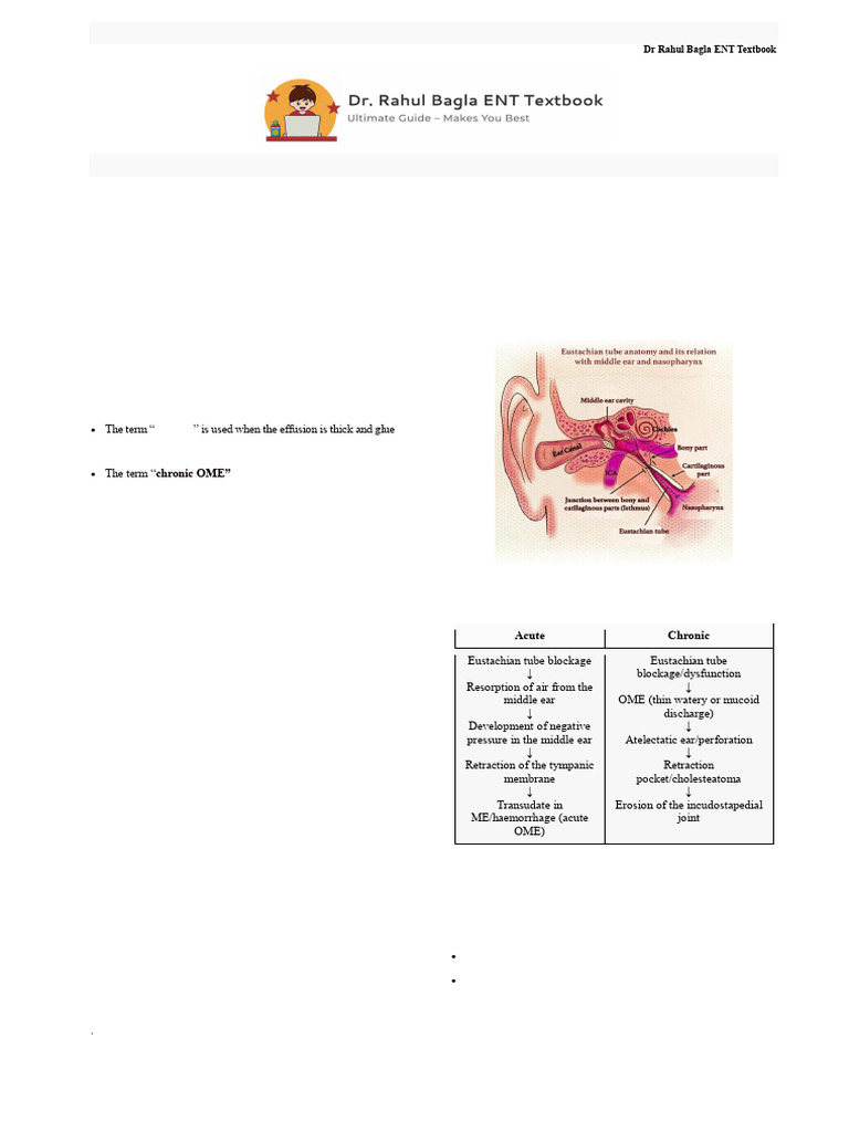Otitis Media With Effusion Best Lecture Notes DR Rahul Bagla ENT ...