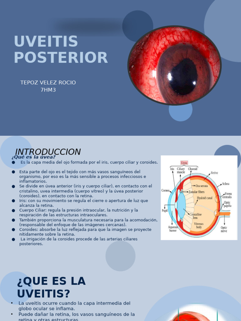 Uveitis Posterior 1 | PDF | Ojo humano | Percepción visual