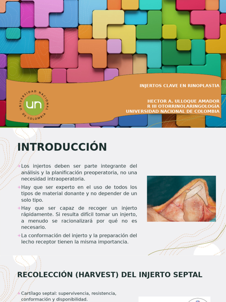 Injertos en Rinoplastia | PDF