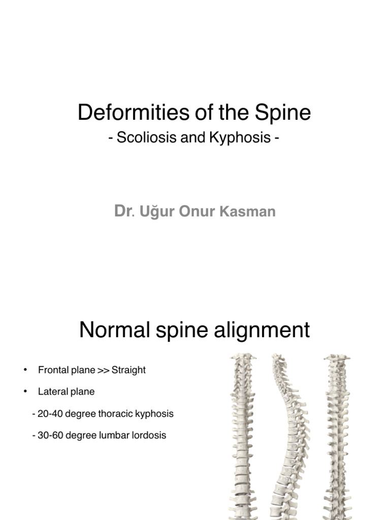 Spinal Deformity | PDF
