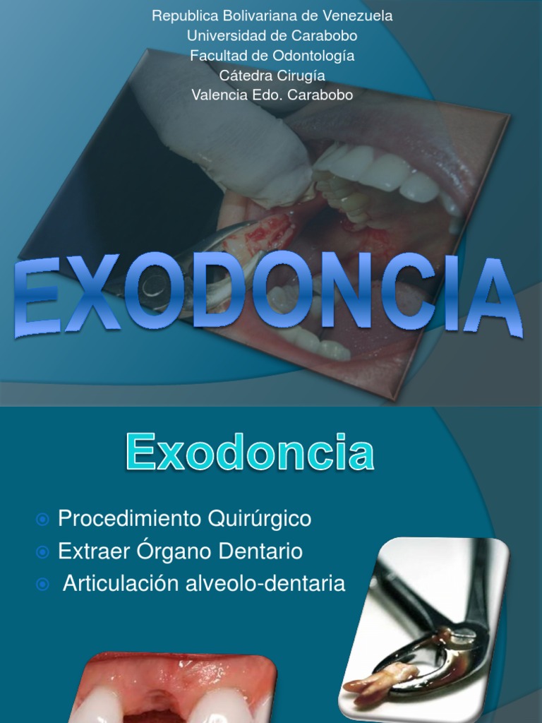 Exodoncia 12 | PDF | Especialidades Medicas | Medicina CLINICA