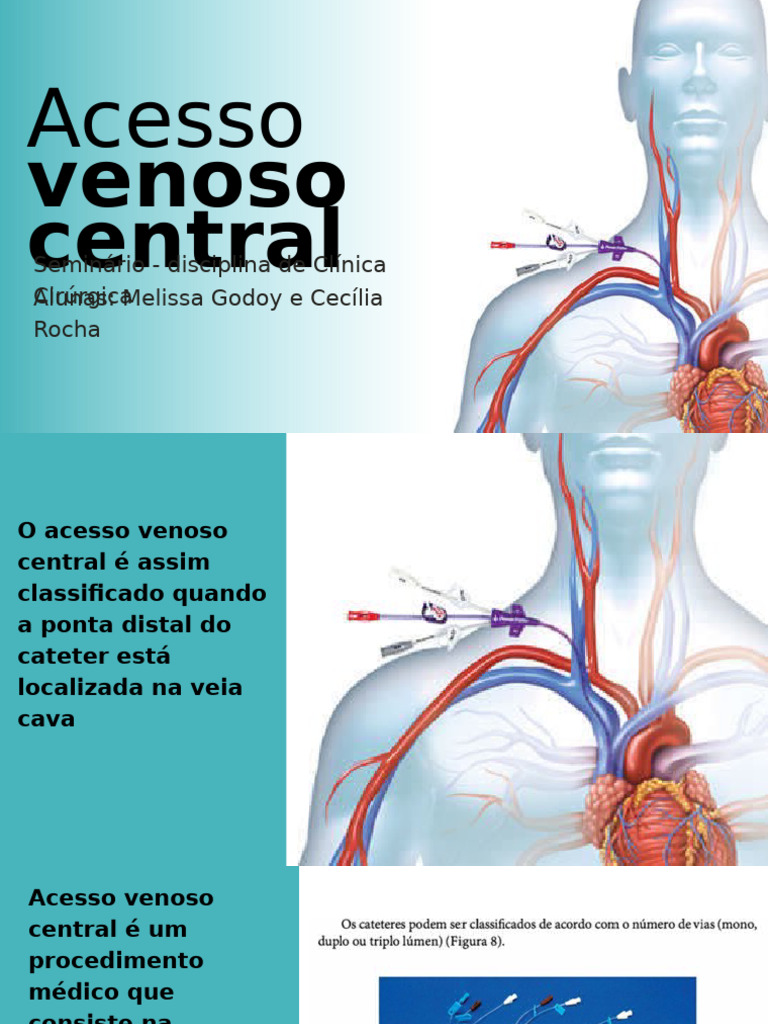 Acesso Venoso Central | PDF | Veia | Angiologia